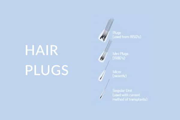 FUE Hair Transplants Before And After | Advanced Hair Studio